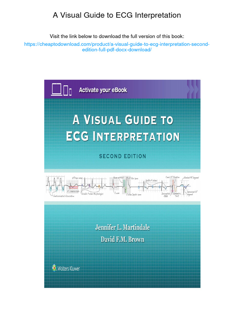 A Visual Guide To ECG Interpretation. Second Edition. | PDF | Action ...