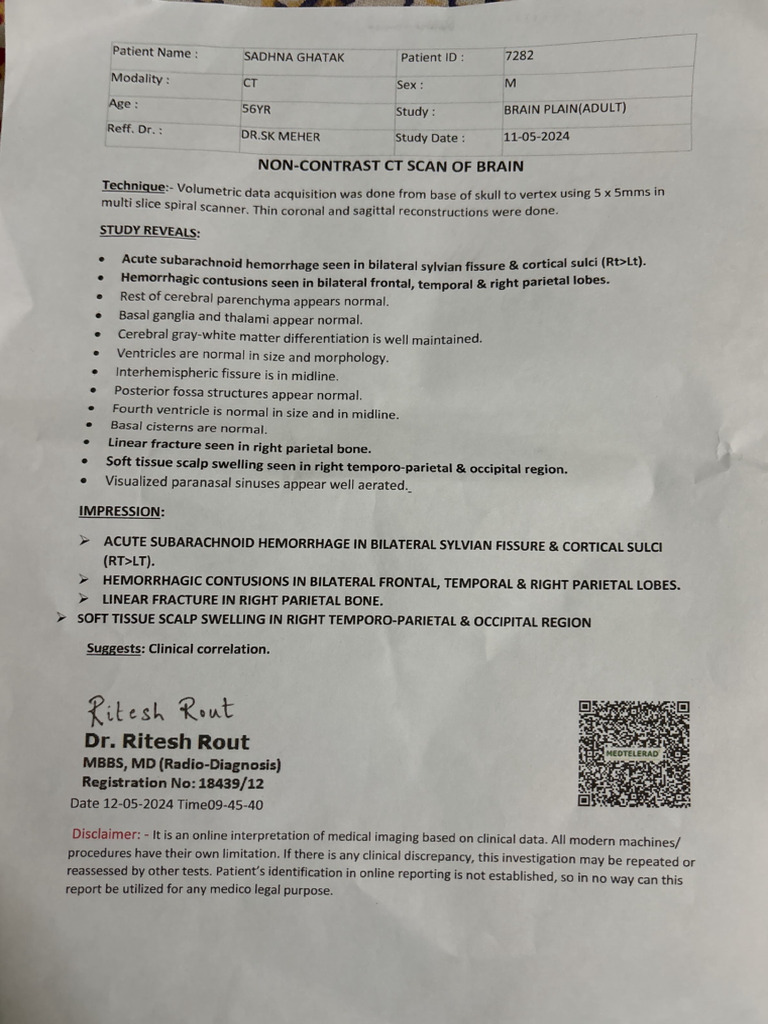 CT Scan Report On 11 May | PDF | Parietal Lobe | Ct Scan