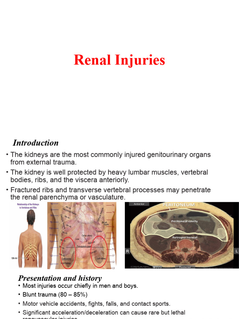 Renal-Injuries Presentation | PDF | Kidney | Ct Scan