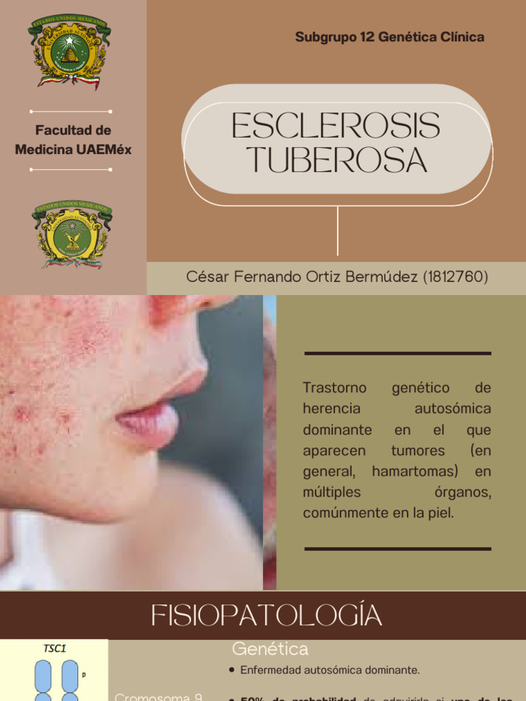 Esclerosis Tuberosa: Guía Clínica | PDF | Enfermedades y trastornos humanos | Causas de la muerte