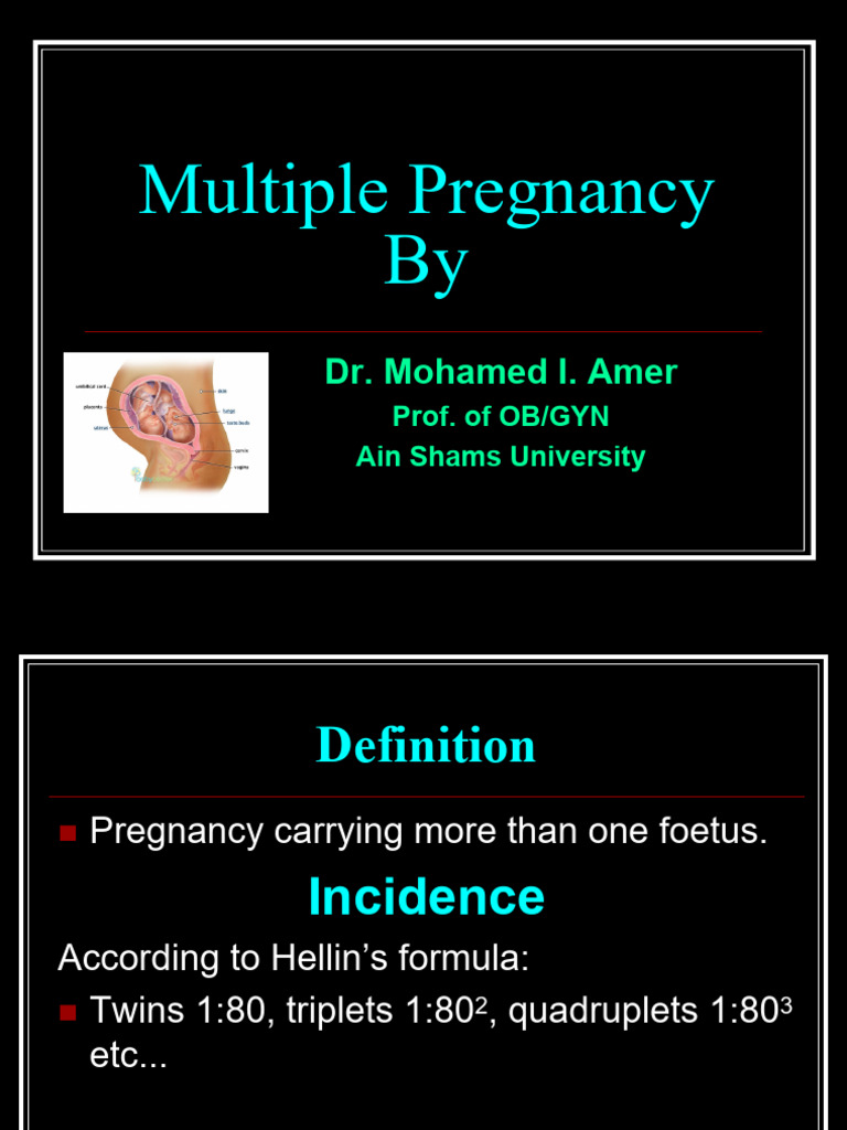Multiple Pregnancy | PDF | Twin | Multiple Births