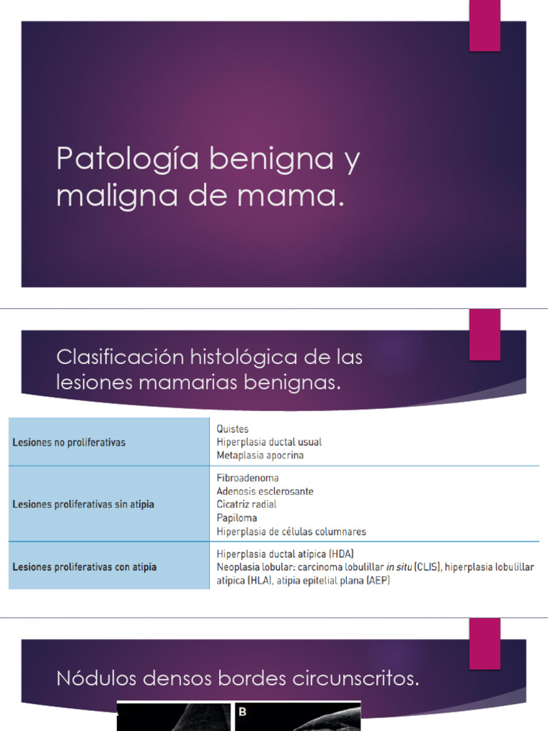 Patología Benigna y Maligna de Mama | PDF