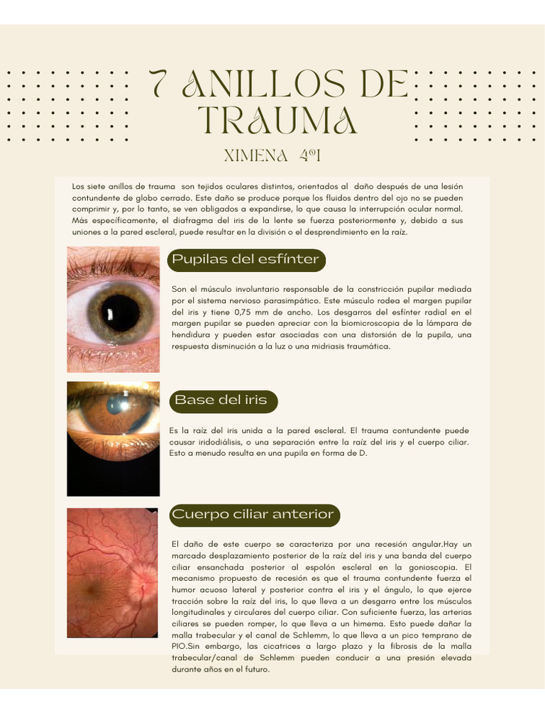 Anillos de Trauma | PDF | Ojo humano | Especialidades Medicas