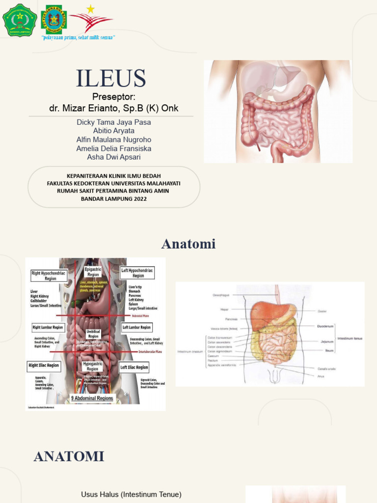 Ileus | PDF