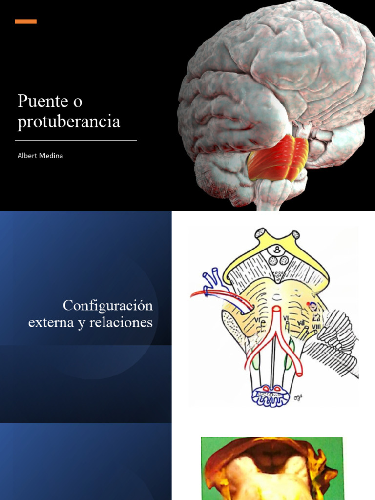 Puente o Protuberancia | PDF