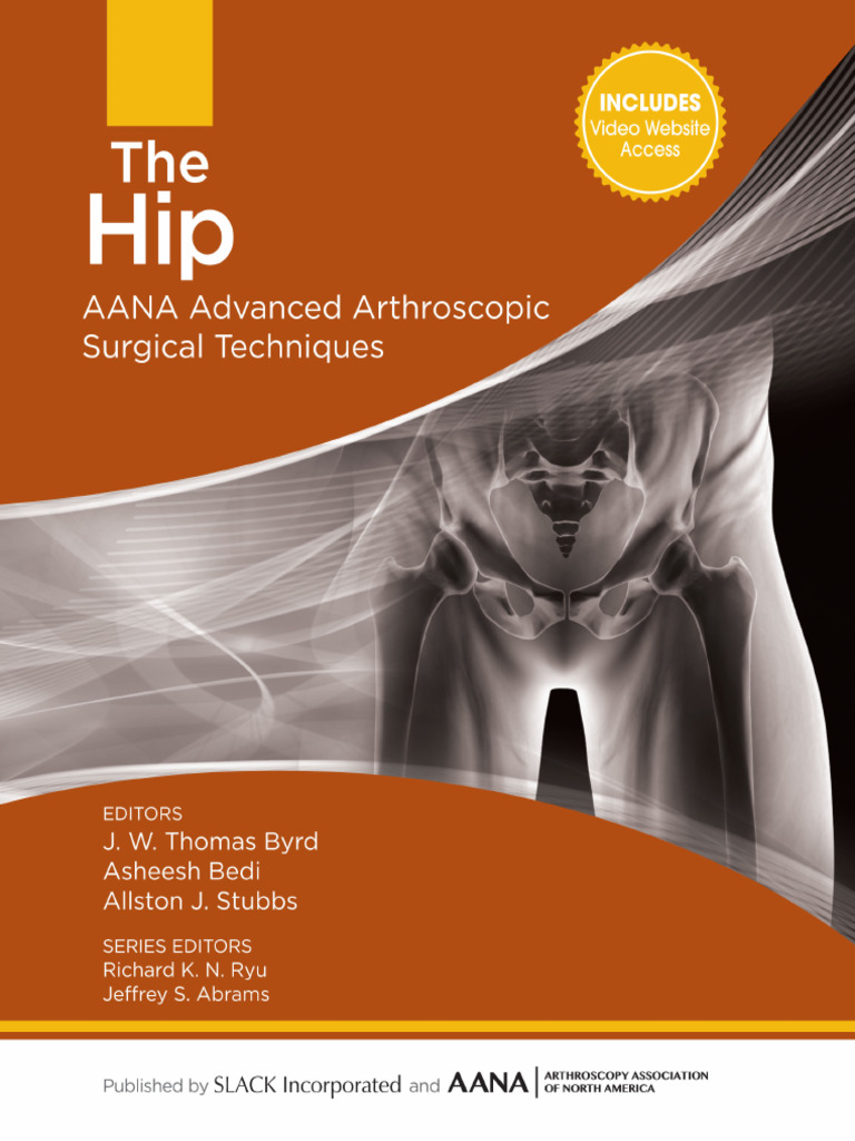 AANA Advanced Arthroscopic Hip Techniques by J W Thomas Byrd, MD ...