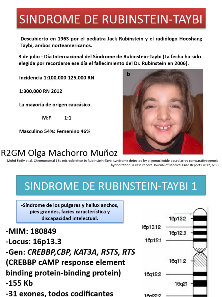 Sindrome de Rubinstein-Taybi | PDF | Genética | Enfermedades y trastornos