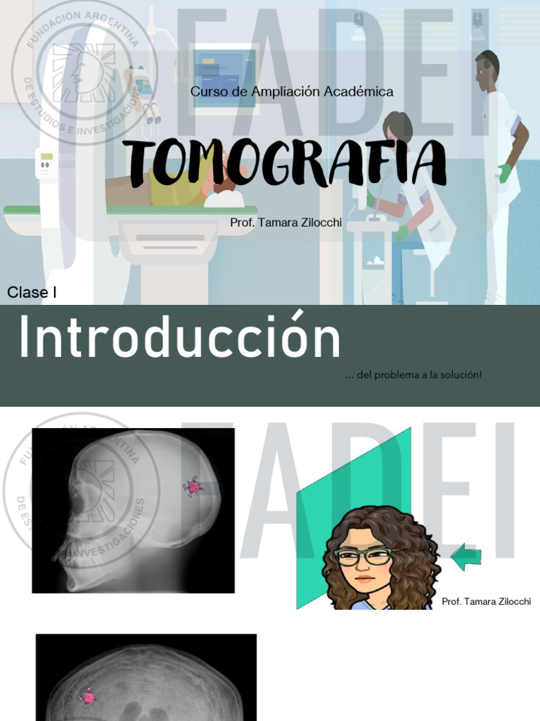 Curso de TC ppt1 | PDF | Ct Scan | Píxel