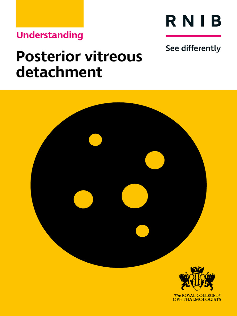 Understanding Posterior Vitreous Detachment - 2020 | PDF | Eye | Human Eye
