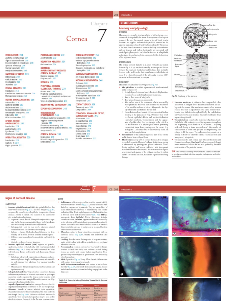 Kanski Cornea | PDF | Cornea | Contact Lens