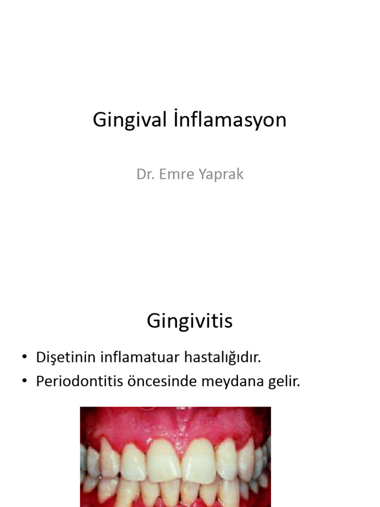 Gingivitis | PDF