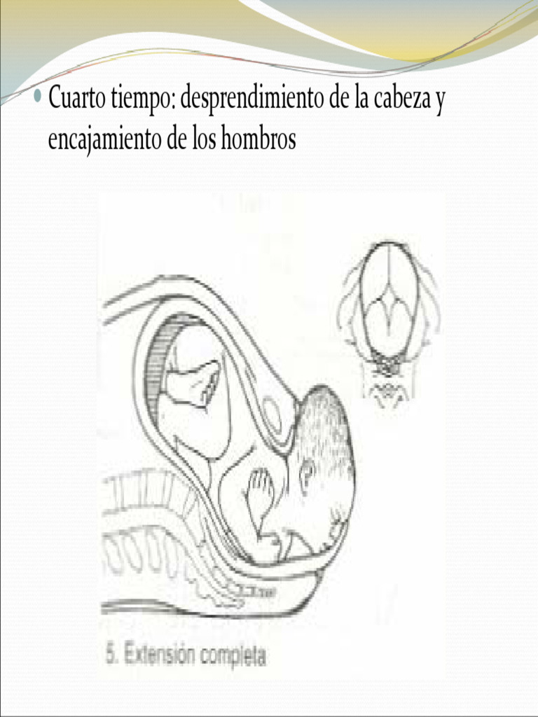 Parto Normal 4to Ano DR Nodarse Parte4 | PDF | Parto | Salud pública