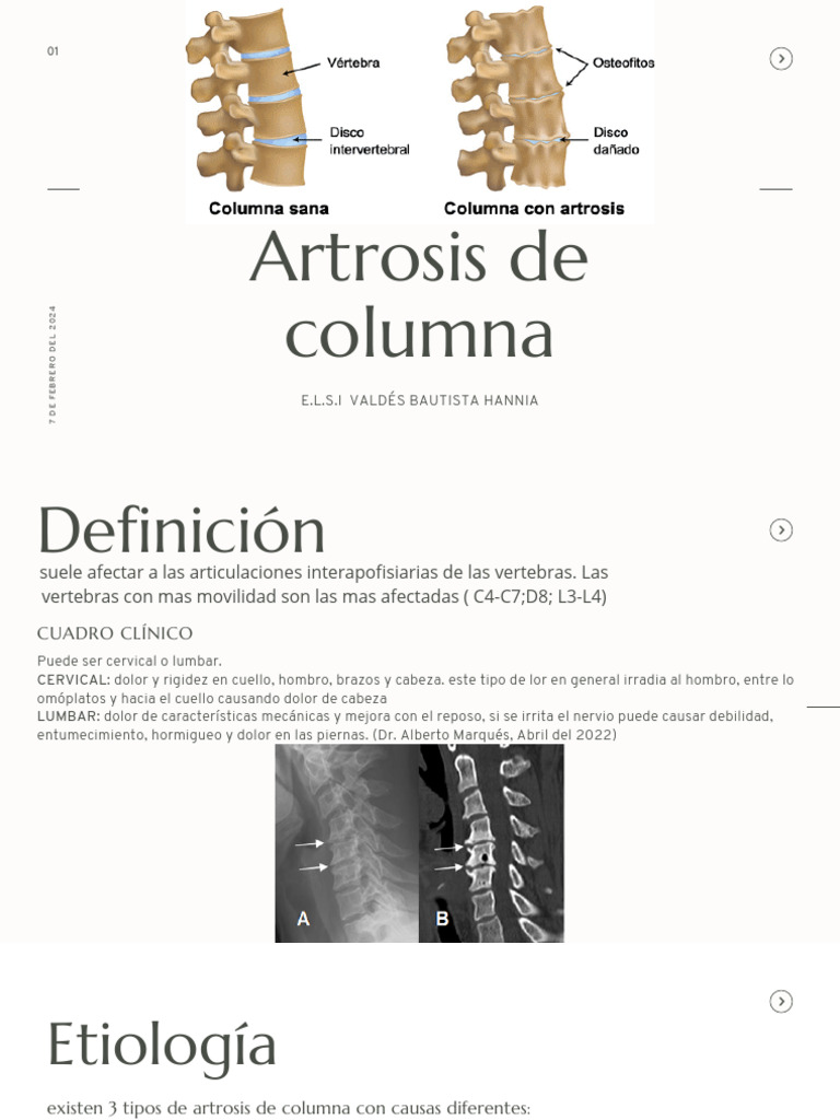 Artrosis de Columna HVB - 20240422 - 085657 - 0000 | PDF | Ciencias ...