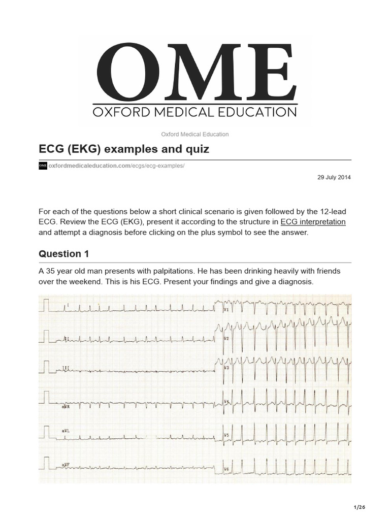 ECG EKG Examples and Quiz | PDF | Electrocardiography | Cardiology