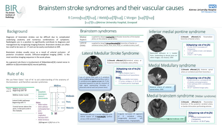 Brainstem Stroke Syndromes and Their Vascular Causes 1 | PDF | Brainstem | Anatomy
