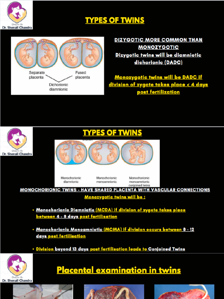 Twins | PDF