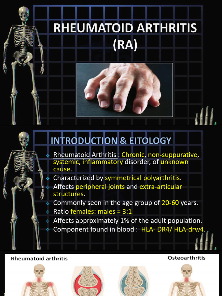 Rheumatoid Arthritis | PDF | Rheumatoid Arthritis | Arthritis