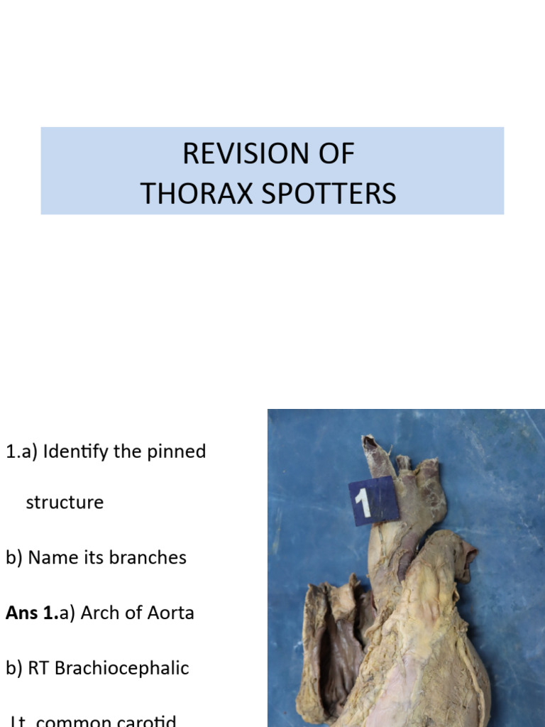 Thorax Anatomy Identification Guide | PDF | Coronary Circulation | Heart