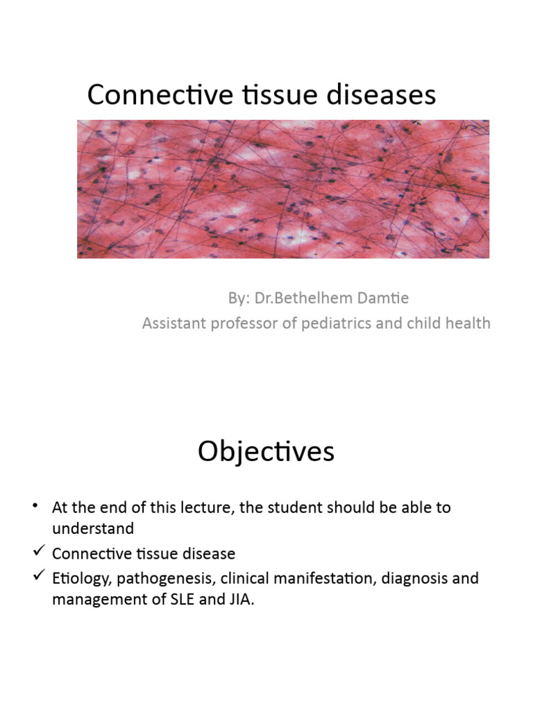 Connective Tissue Diseases | PDF | Rheumatoid Arthritis | Arthritis