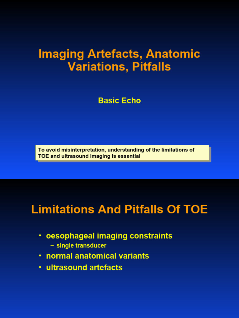 Basic Echo | PDF | Echocardiography | Cardiovascular System
