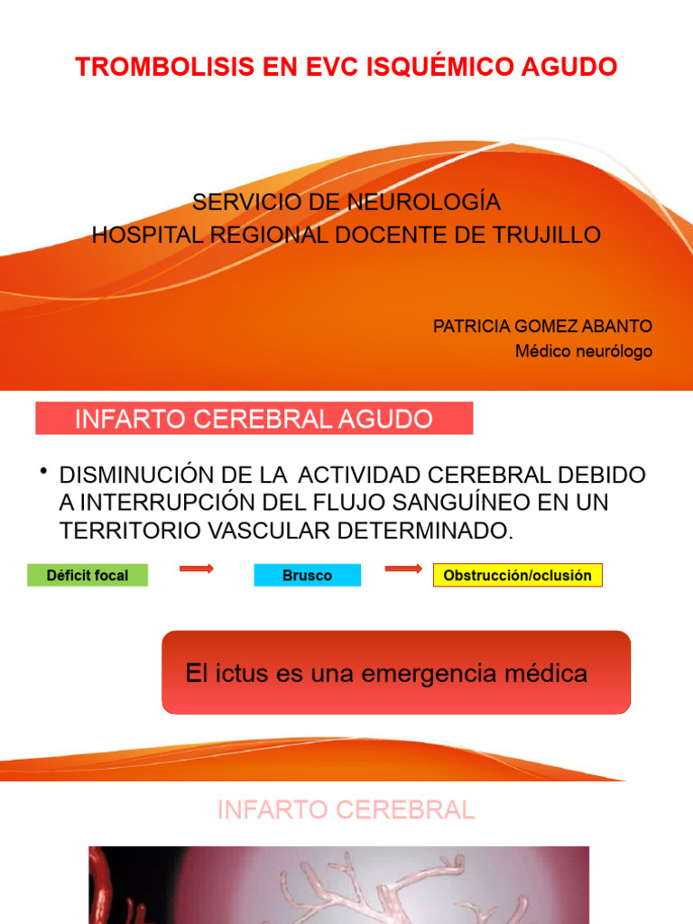 Trombolisis en Evc Isquemico | PDF | Carrera | Isquemia