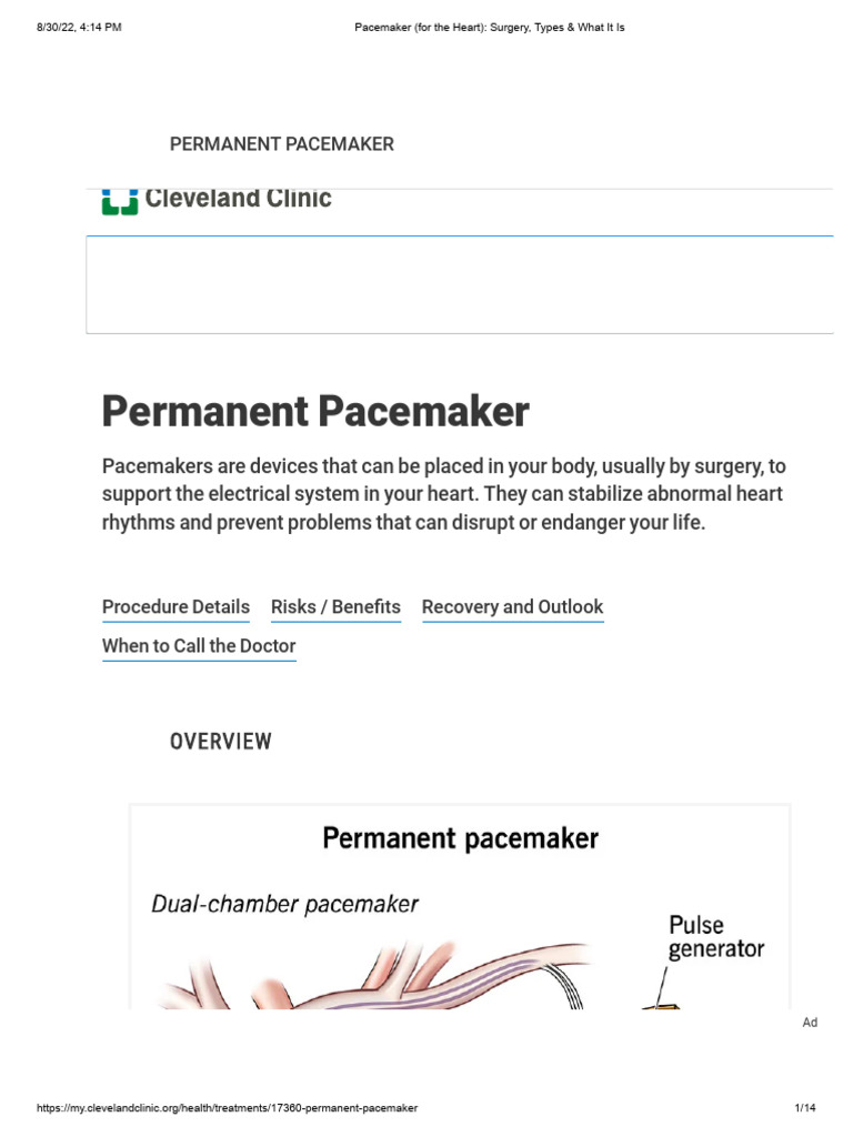 Pacemaker (For The Heart) - Surgery, Types & What It Is | PDF ...