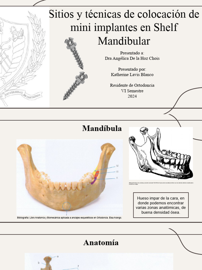 Mini Implantes en Shelf Mandibular | PDF | Morfología (biología) | Anatomía