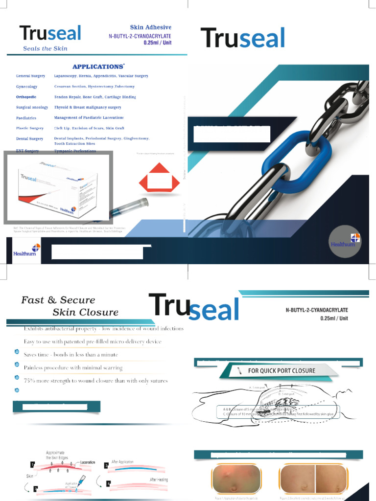 Truseal LBL - AB8 - Curved | PDF