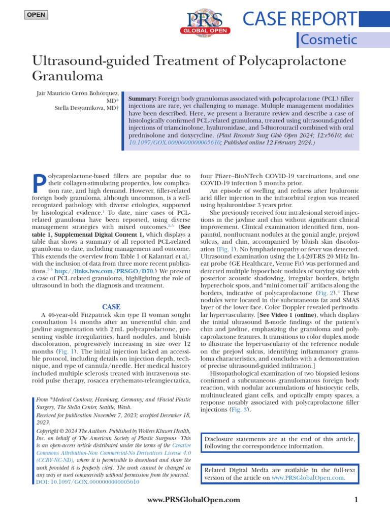 Ultrasound-Guided Treatment of Polycaprolactone Granuloma | PDF ...