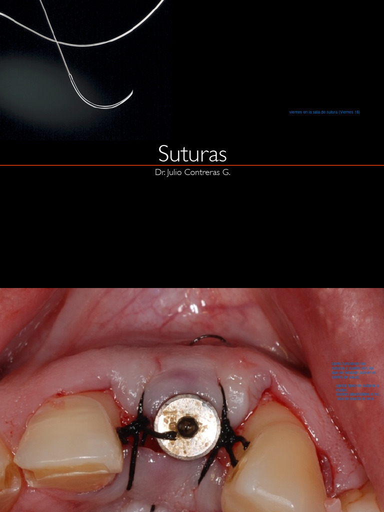 suturas diplomado | PDF | Surgical Suture | Surgery