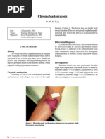 Patient-Scale POSAS-3.0 Generic-Scar English | PDF | Paresthesia | Medicine
