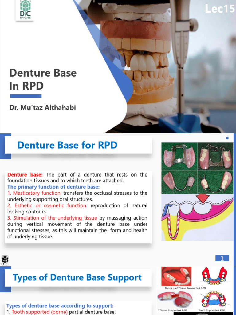 Pros3 Lec.15 Denture Base in RPD | PDF | Dentures | Mouth