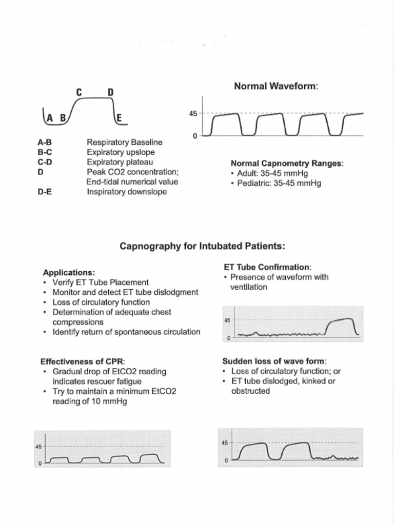 Capnography Waveforms | PDF