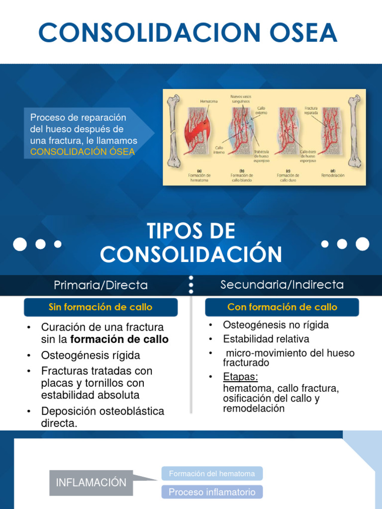 Generalidades de Fracturas y Fisiología de La Consolidación | PDF | Hueso | Inflamación