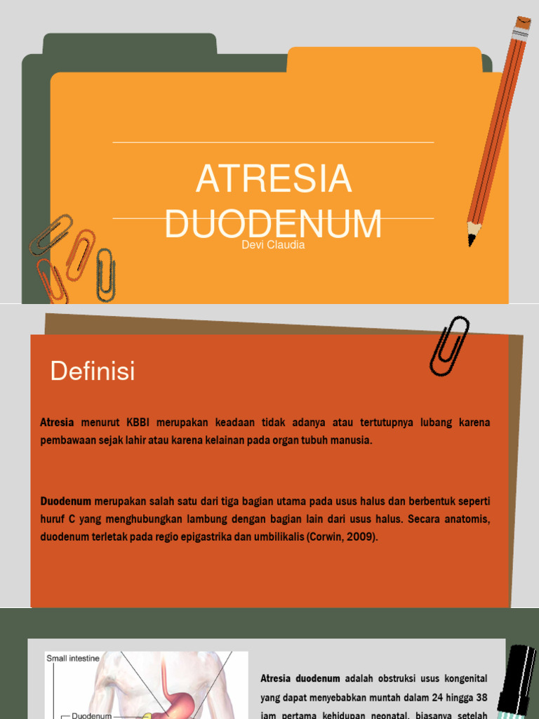 Atresia Duodenum. | PDF