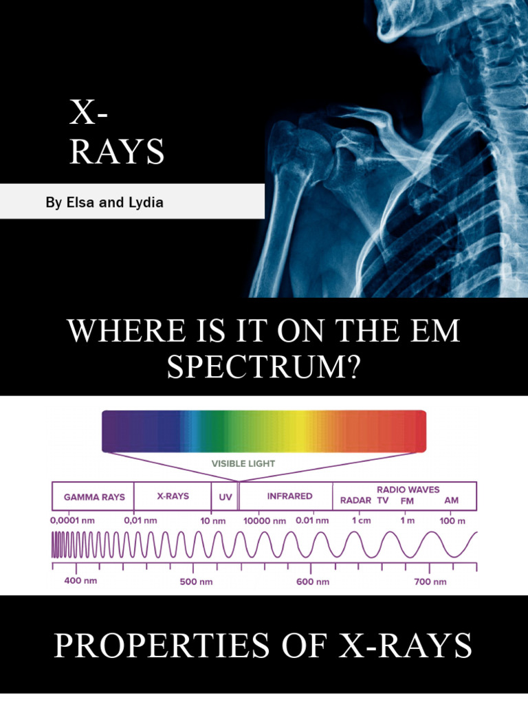 Xrays | PDF