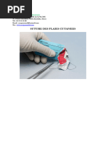 Types et techniques de points de suture | PDF | Suture (médecine ...