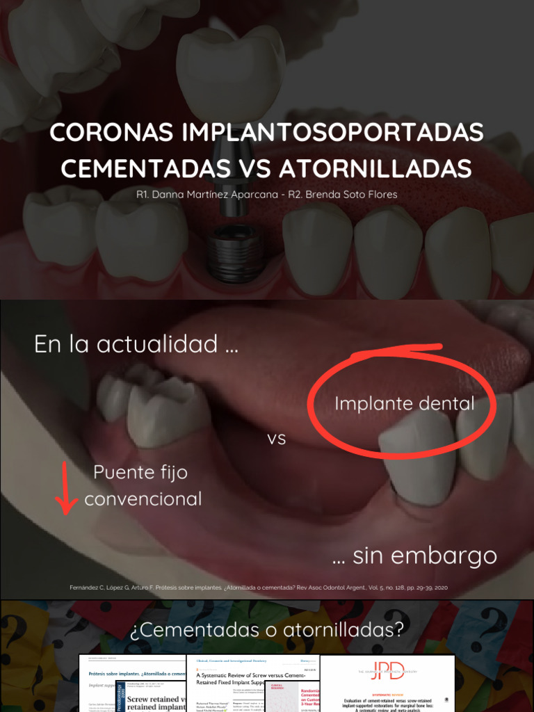 Comparativa de coronas atornilladas y cementadas | PDF | Implante ...