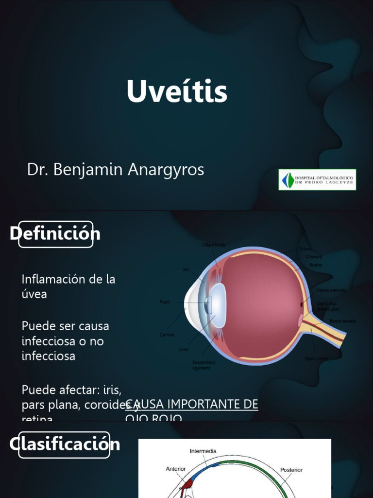 Guía Completa sobre Uveítis: Causas y Síntomas | PDF | Inflamación ...