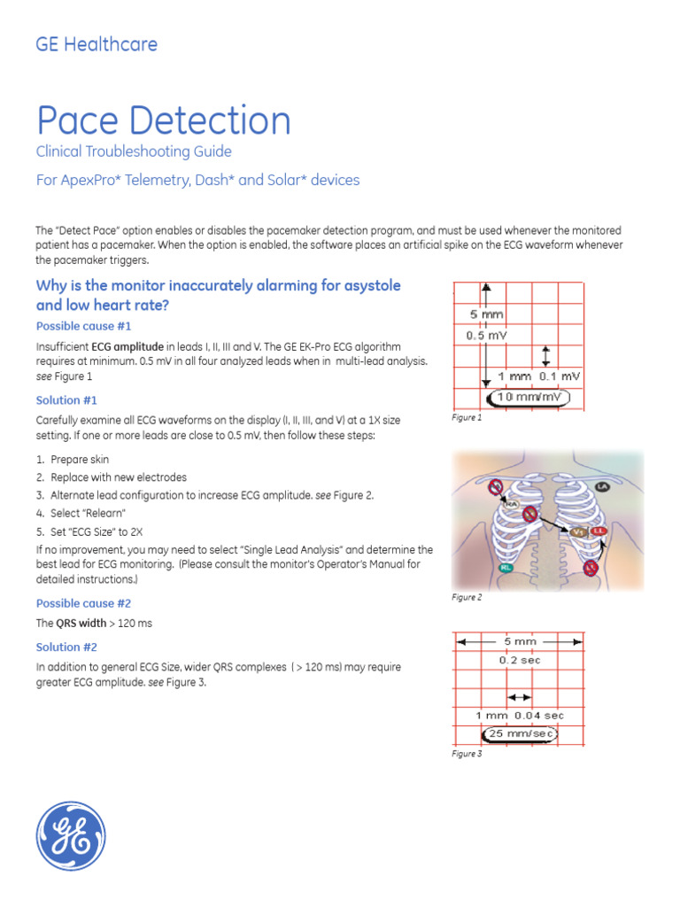 Pace Detection_Clinical Troubleshooting Guide_DOC1018666 | PDF ...