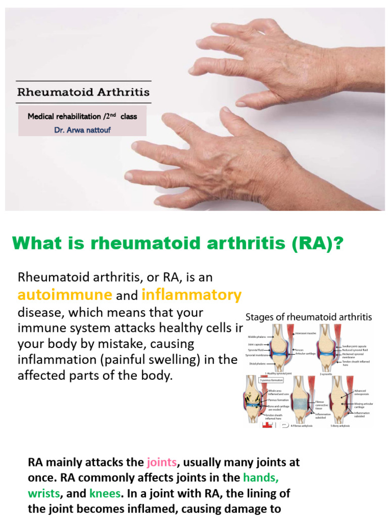 Ra - 2 | PDF | Rheumatoid Arthritis | Autoimmune Disease