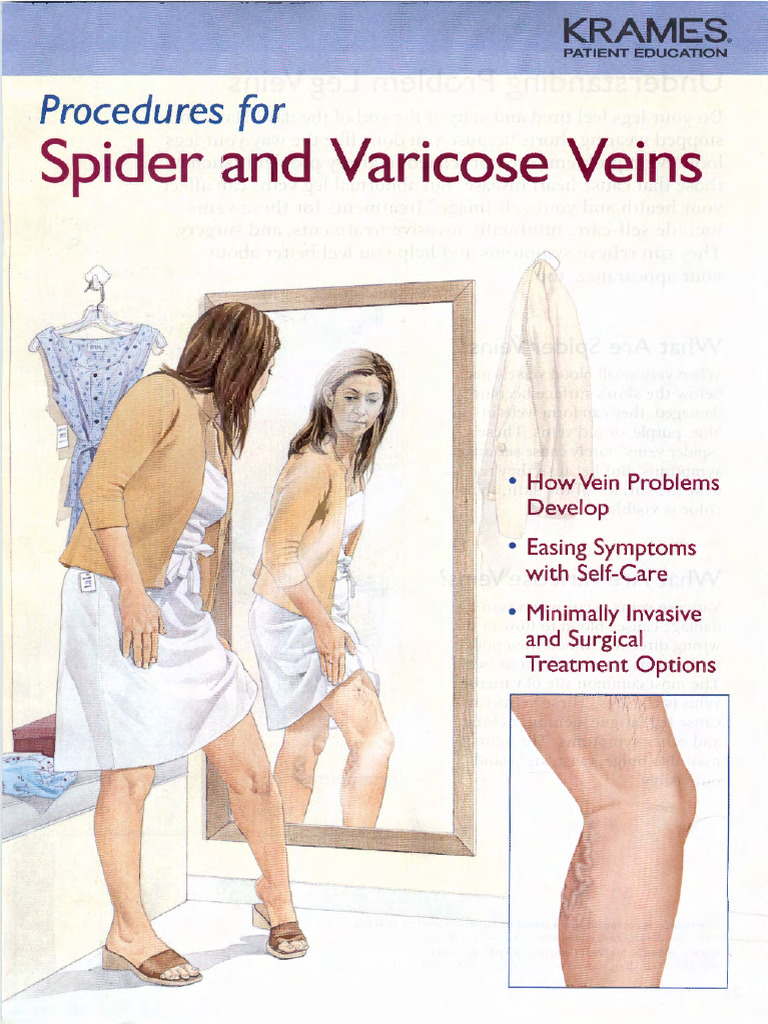 Prodedures for Spider and Varicose Veins | PDF | Vein | Varicose Veins