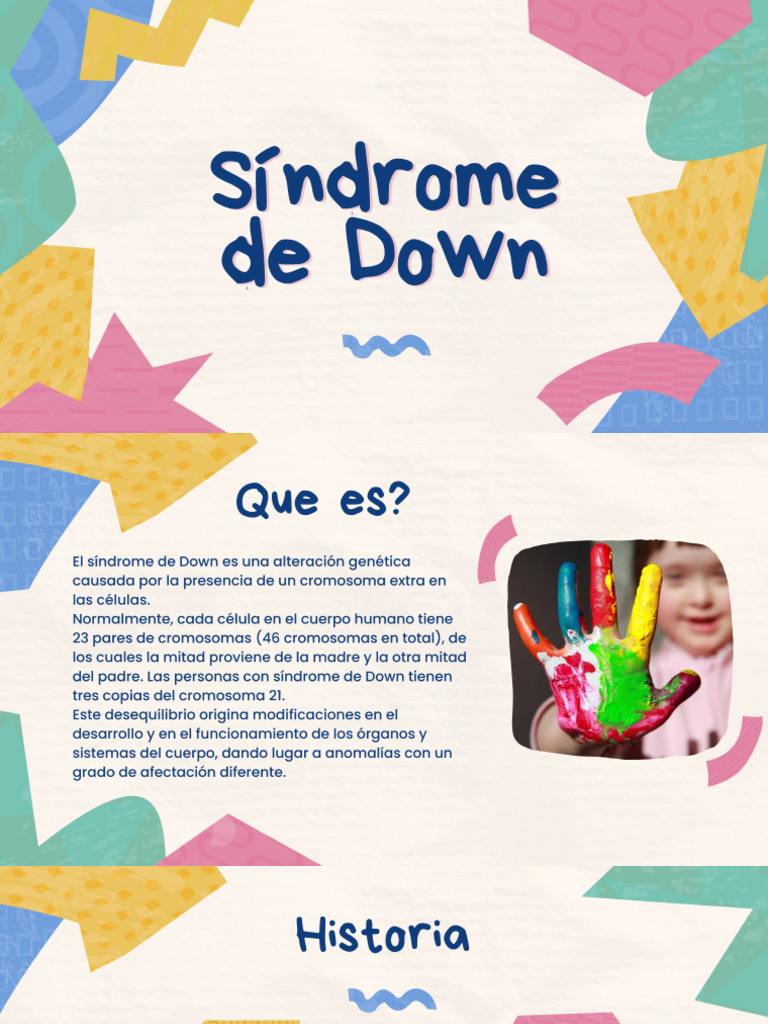 Sindrome de Down | PDF