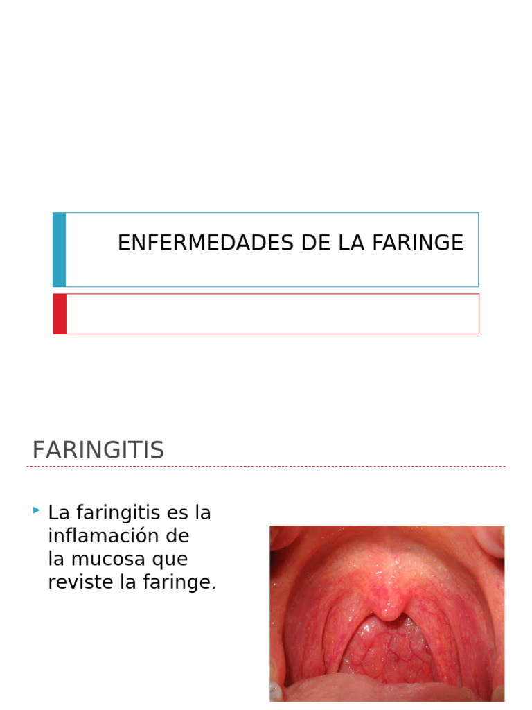 Enfermedades Faringe | PDF | Esófago | Cáncer