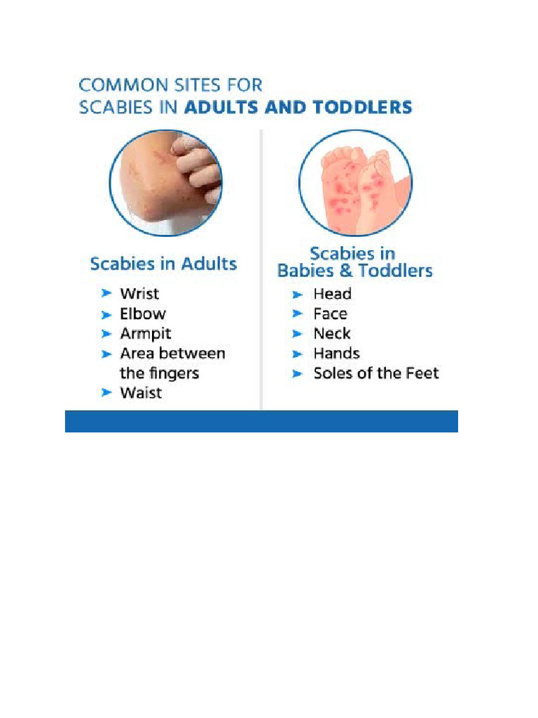Scabies | PDF