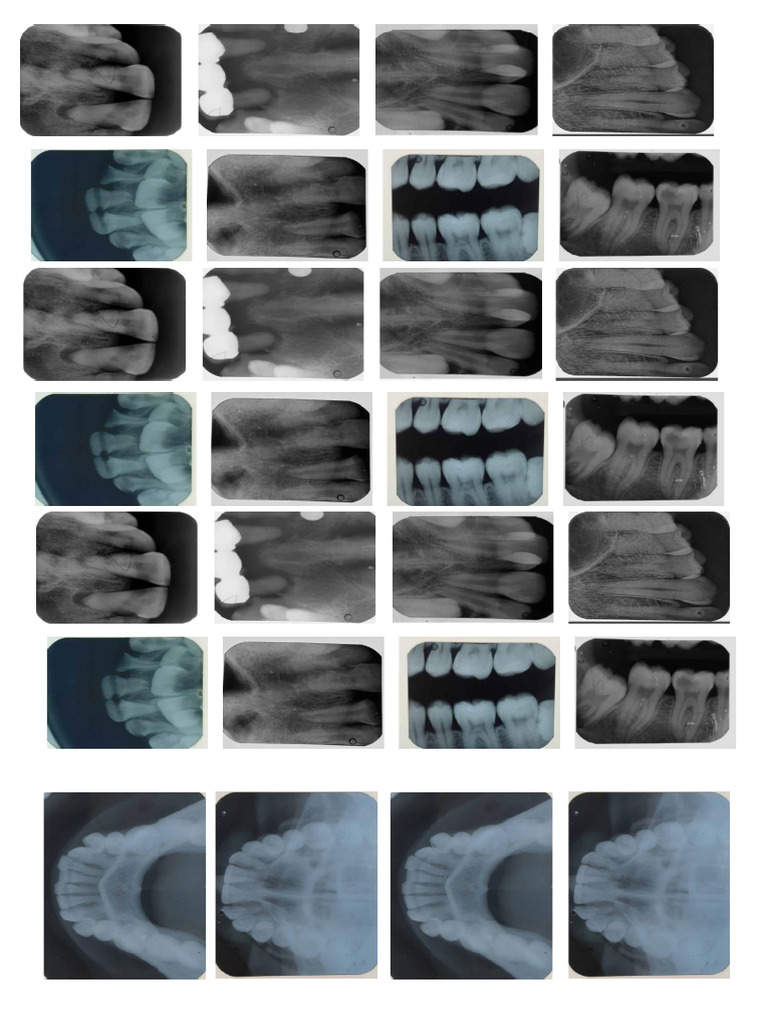 Radiographs | PDF