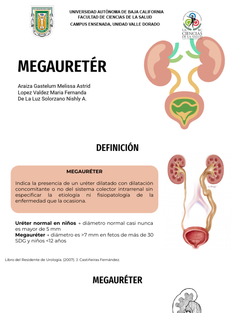 Megaureter | PDF | Medicina | Urología