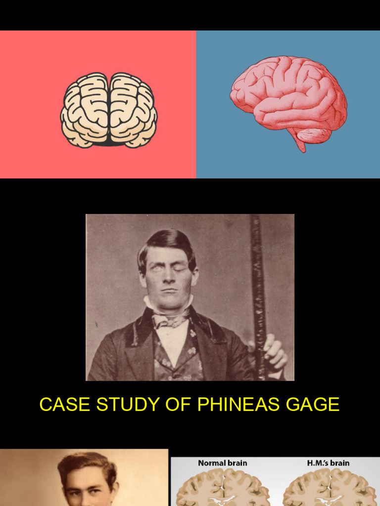 Neuroplasticity Theory | PDF | Science & Mathematics