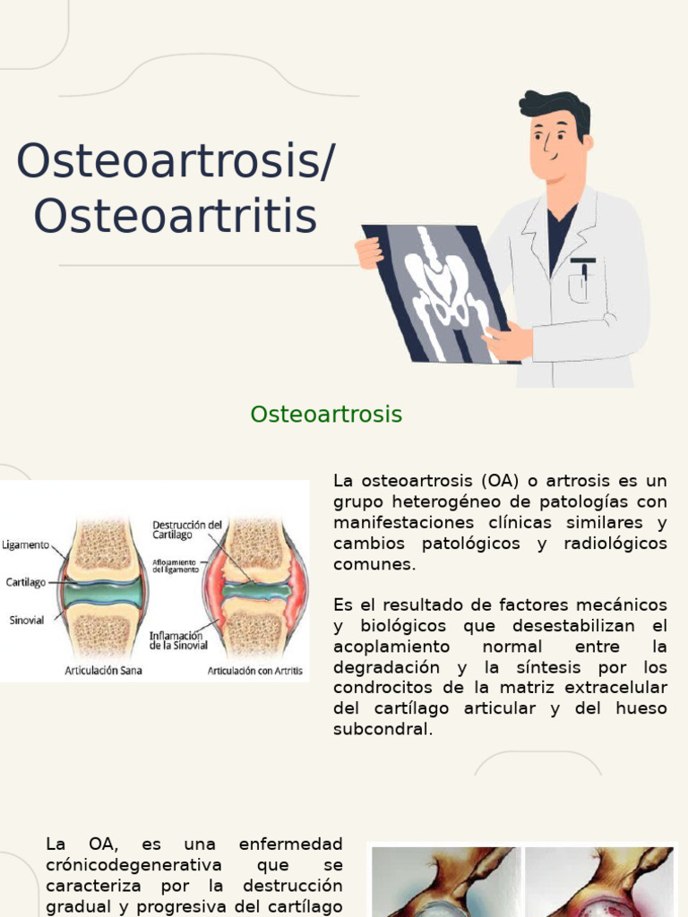 Clase Osteoartritis - Osteoartrosis Ortopedia HGPALT Terminda | PDF ...