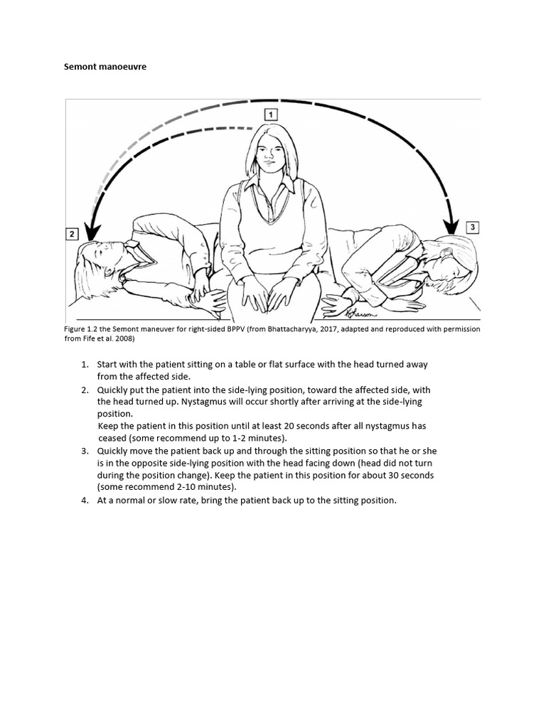 Semont Maneuver for BPPV Treatment | PDF | Wellness